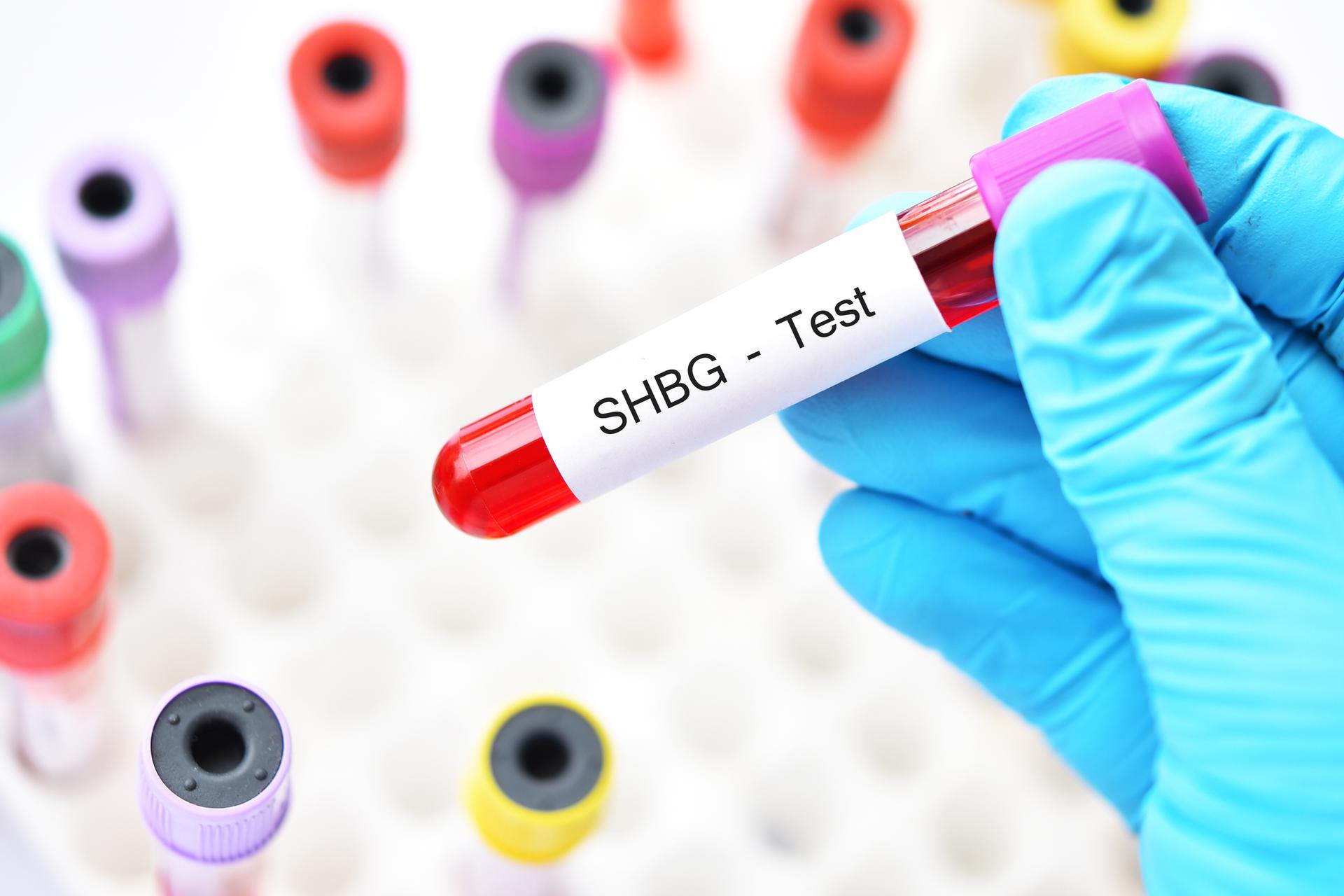 SHBG – jak wpływa na gospodarkę hormonalną? – Patryk Iwański